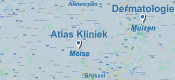 Wat zijn spataders? | Dr. Ellen Jennes - regio Mechelen